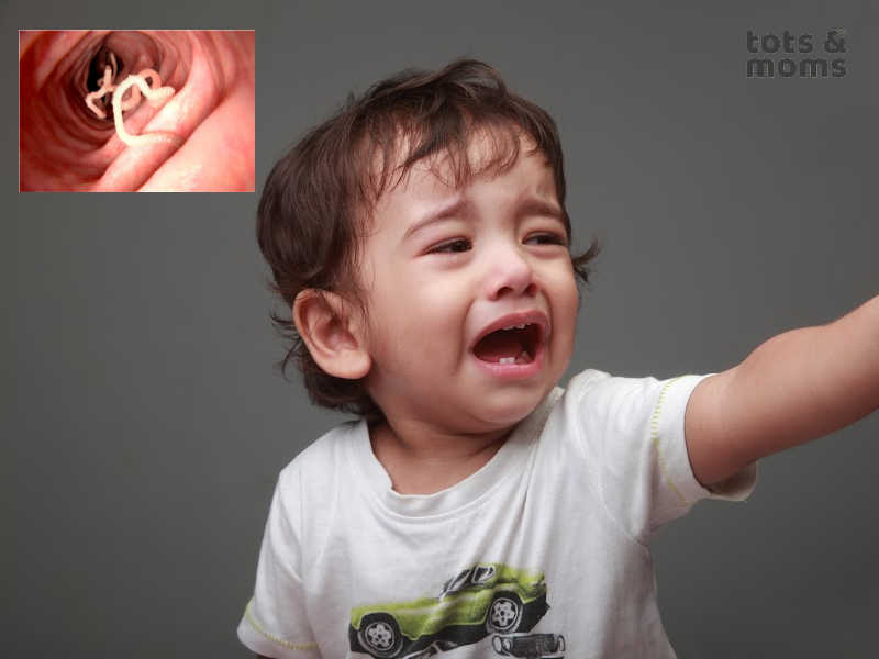 Intestinal Worms - Reasons, Symptoms and Cure